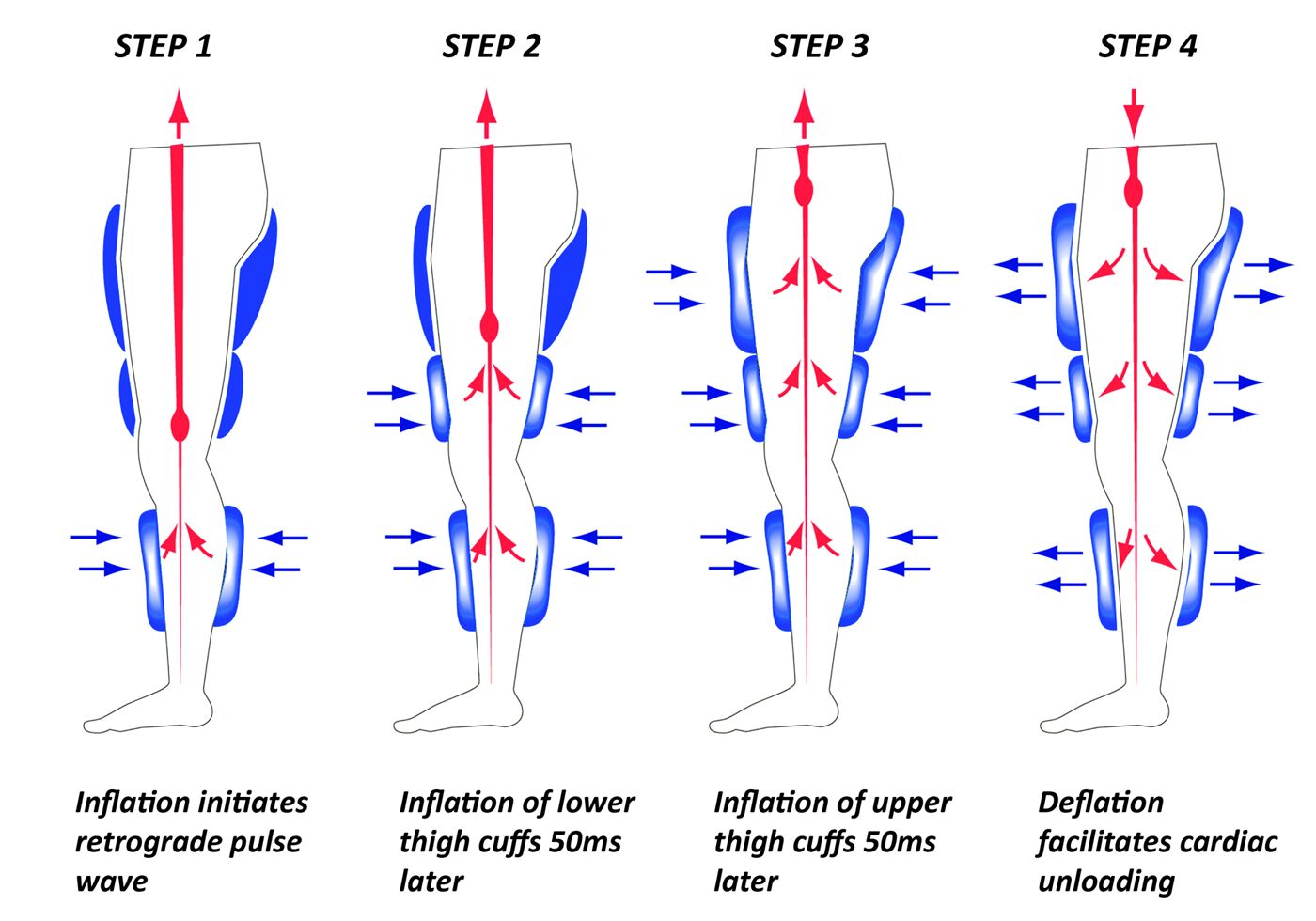 Recovery Science Inc. | EECP Therapy ECP | Recovery Science Inc.